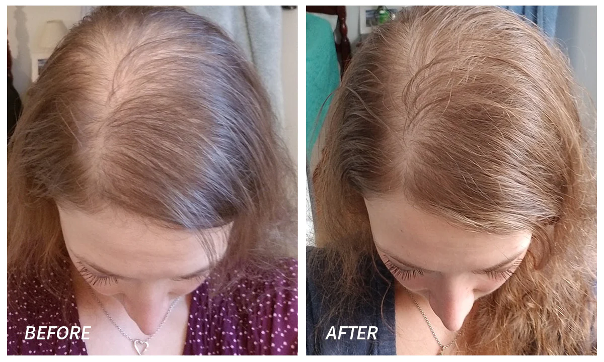 At Home Infrared Red light hair growth Cap with 120 LED