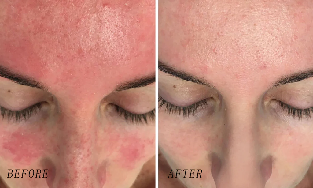 7 Colors Pdt Led Light Therapy Machine Light Therapy